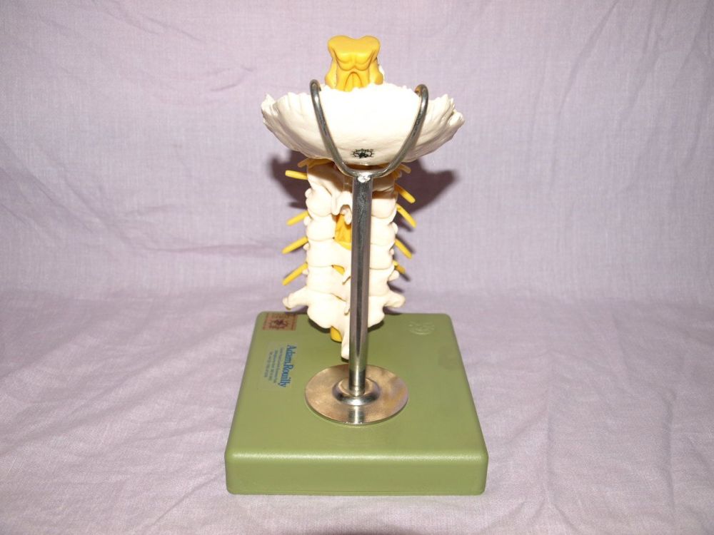 Somso Neck Spine Professional Anatomical Model, Adam Rouilly.