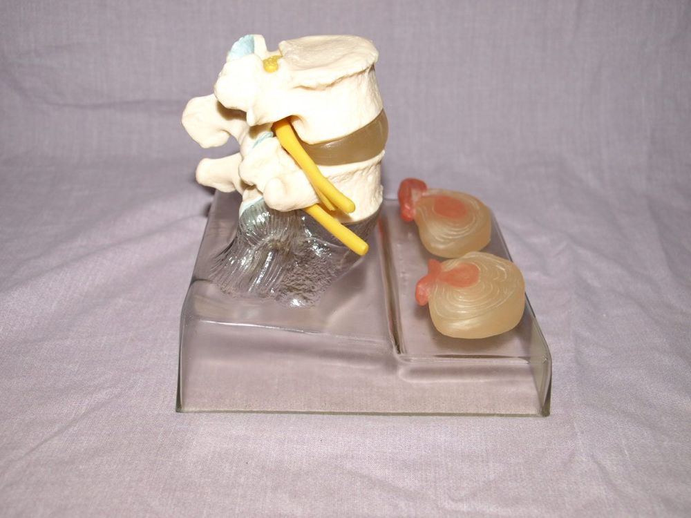 Somso Spine Backbone Vertebrae Professional Anatomical Model, Adam Rouilly.