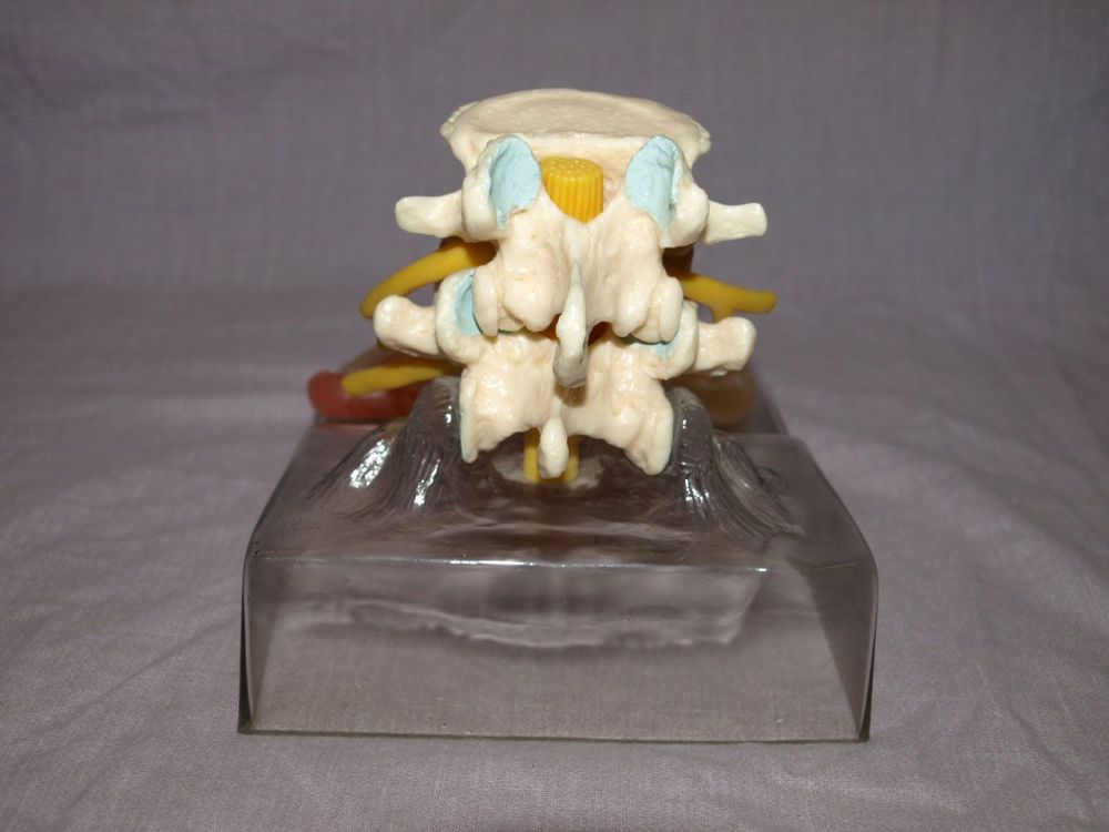 Somso Spine Backbone Vertebrae Professional Anatomical Model, Adam Rouilly.