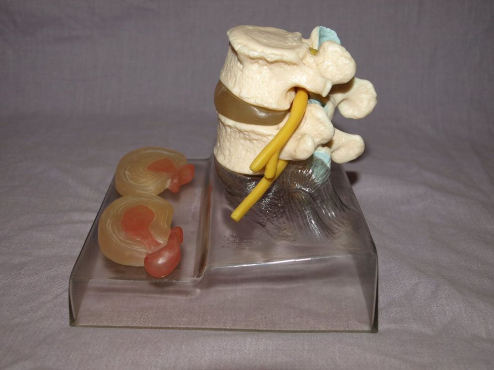 Somso Spine Backbone Vertebrae Professional Anatomical Model, Adam Rouilly.