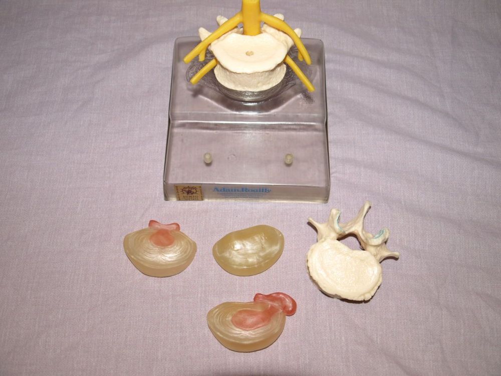 Somso Spine Backbone Vertebrae Professional Anatomical Model, Adam Rouilly.