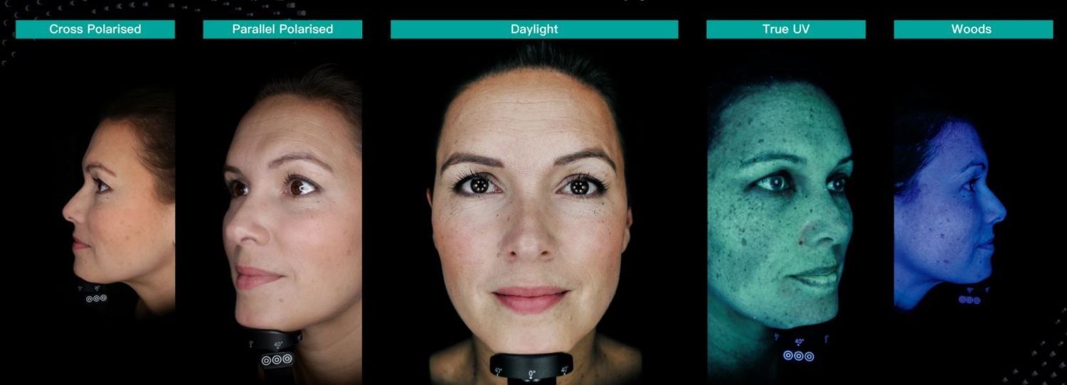 THE VANITY CASE - Observ Skin Analysis