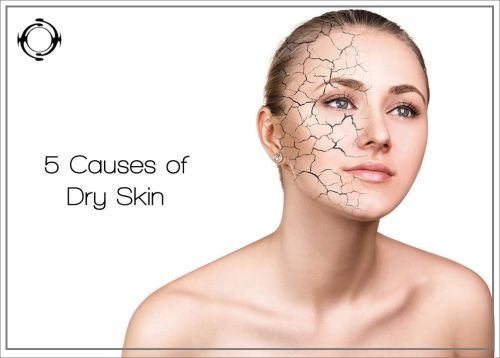 top 5 causes of dry skin
