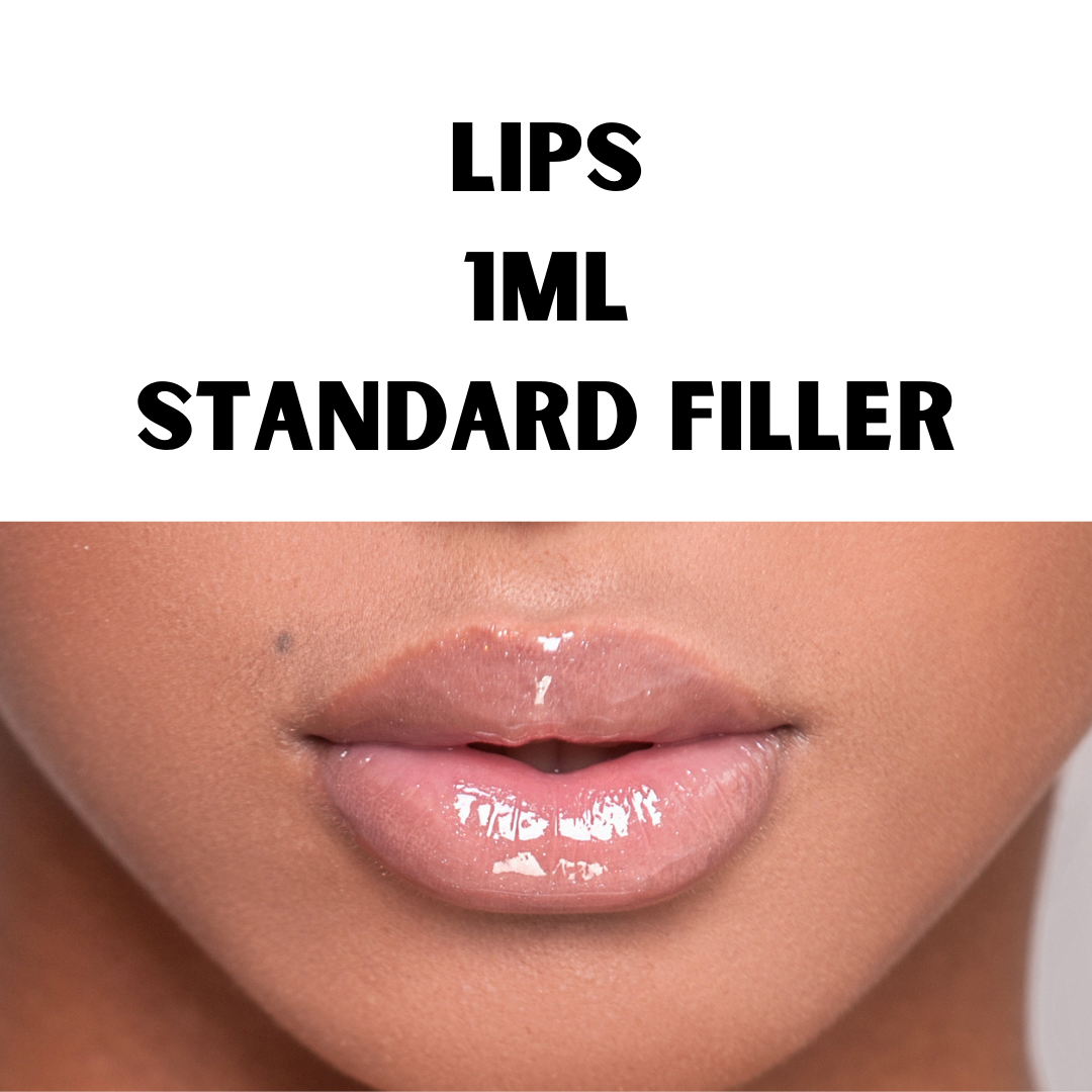 Lip Filler Standard 1ml Lip Filler Standard 1ml